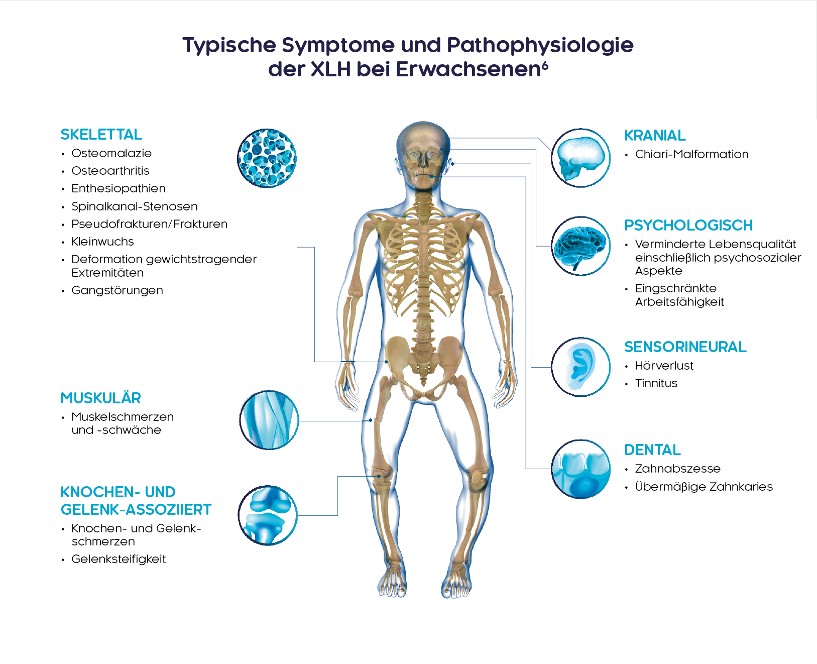 WAS IST XLH? – Kyowa Kirin Hub