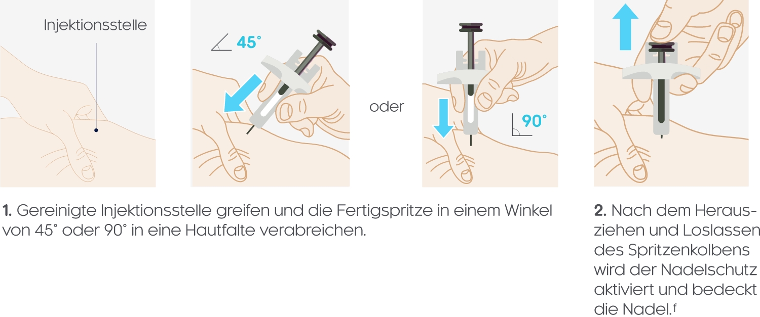 Burosumab zur Selbstanwendung bei XLH